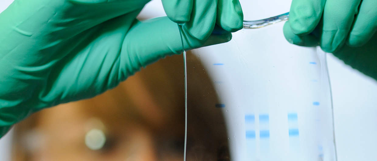 Celldex Therapeutics Inc. (CLDX) Plunges 11.39% on April 02 - Biotech Today