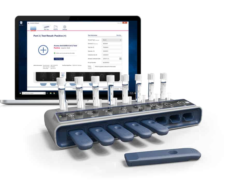 Qiagen to launch digital, portable test for COVID-19 antibodies ...