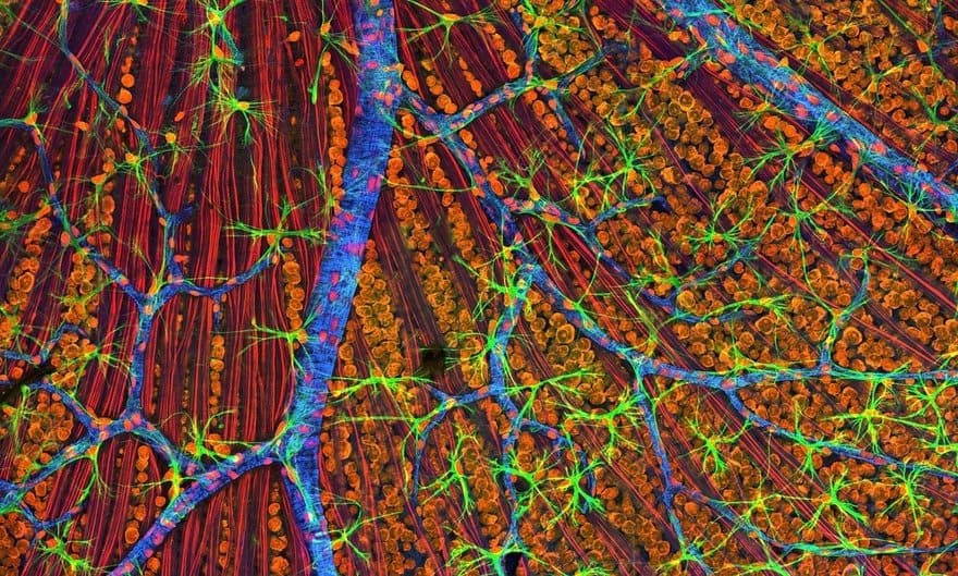 Surgical glue developer Tissium banks €50M to expand into nerve, hernia ...