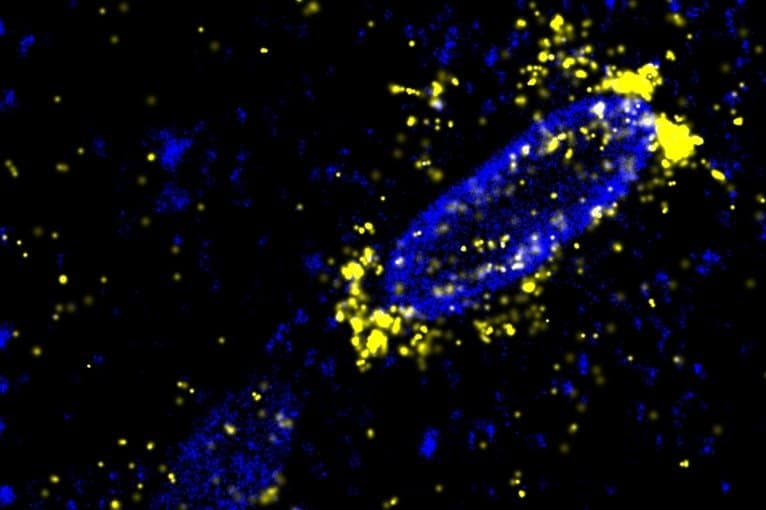 Super-resolution microscope maker Oni nabs $75M for US expansion ...