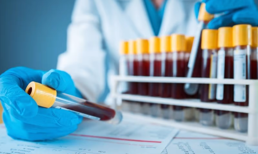 Caris Life Sciences to launch cancer blood test that spans a whopping ...