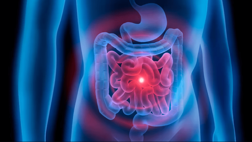 A vibrating pill for constipation heads to the FDA after completing ...