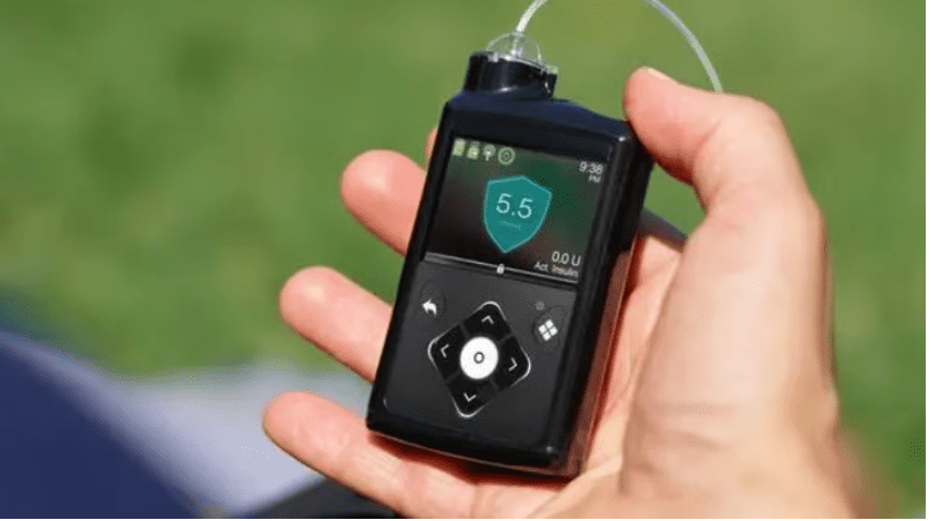 Still awaiting US approval, Medtronic's auto-adjusting insulin pump ...