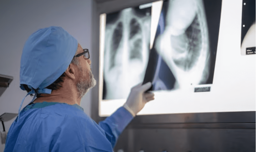 Deep learning AI could predict heart disease death from a chest X-ray ...