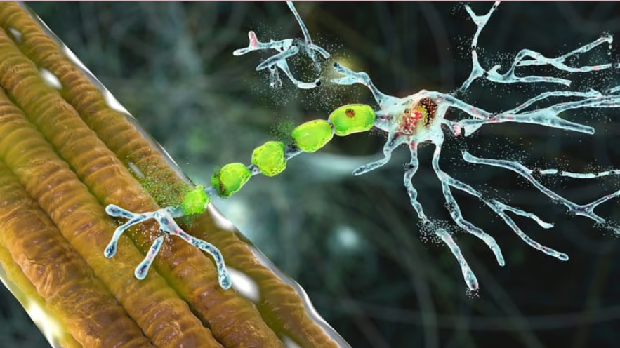 Looking to Biogen's success, Clene claims its ALS therapy hits ...