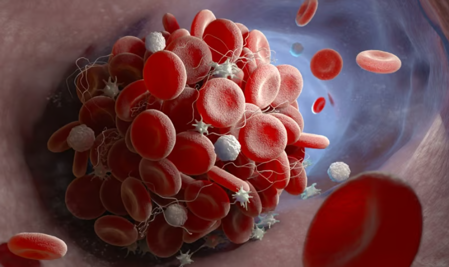 Terumo's automated blood processing system snags FDA clearance to boost ...