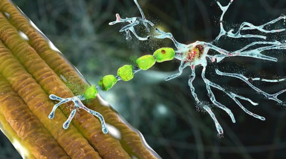 Clene polishes tarnished ALS asset with long-term survival data ...