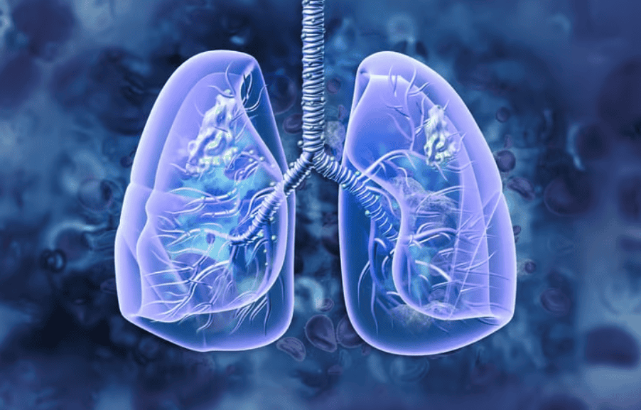 Blueprint tears up plans, dropping 2 lung cancer programs after seeing ...