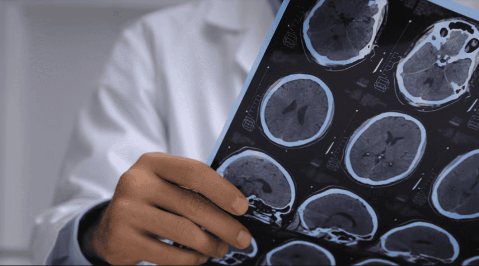 Abbott advances its hand-held, rapid blood test for TBI, concussions ...