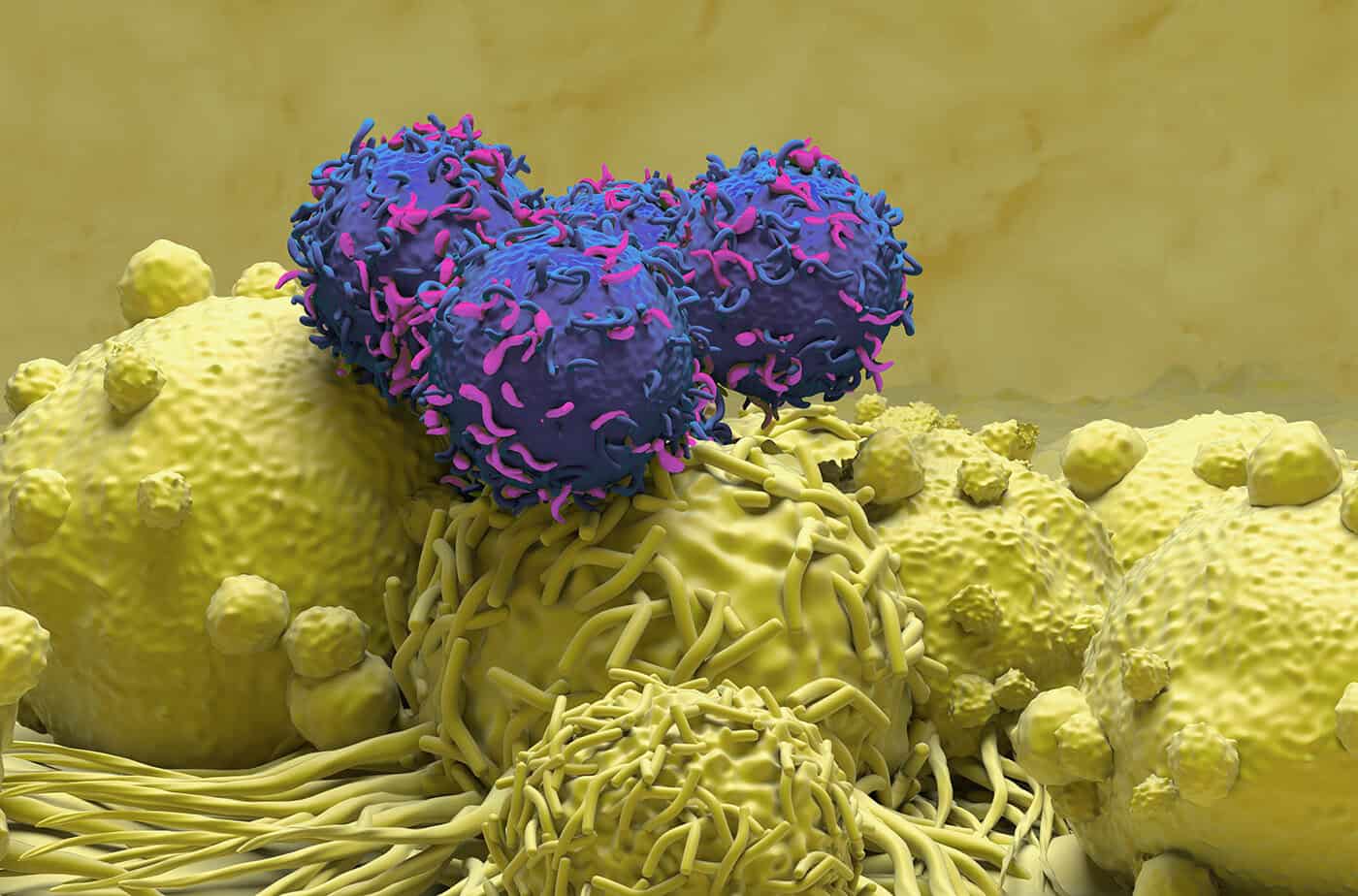 Macrophage-Targeting CAR T Cell Therapy Improves Survival in Solid ...