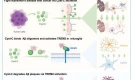 Cancer tumors may protect against Alzheimer's by cleaning out protein ...